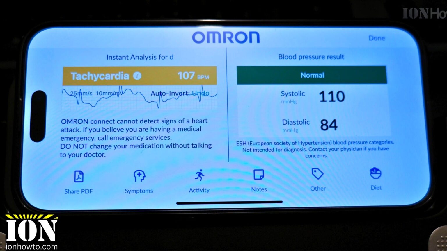 Omron Complete Blood Pressure and ECG Monitor Setup